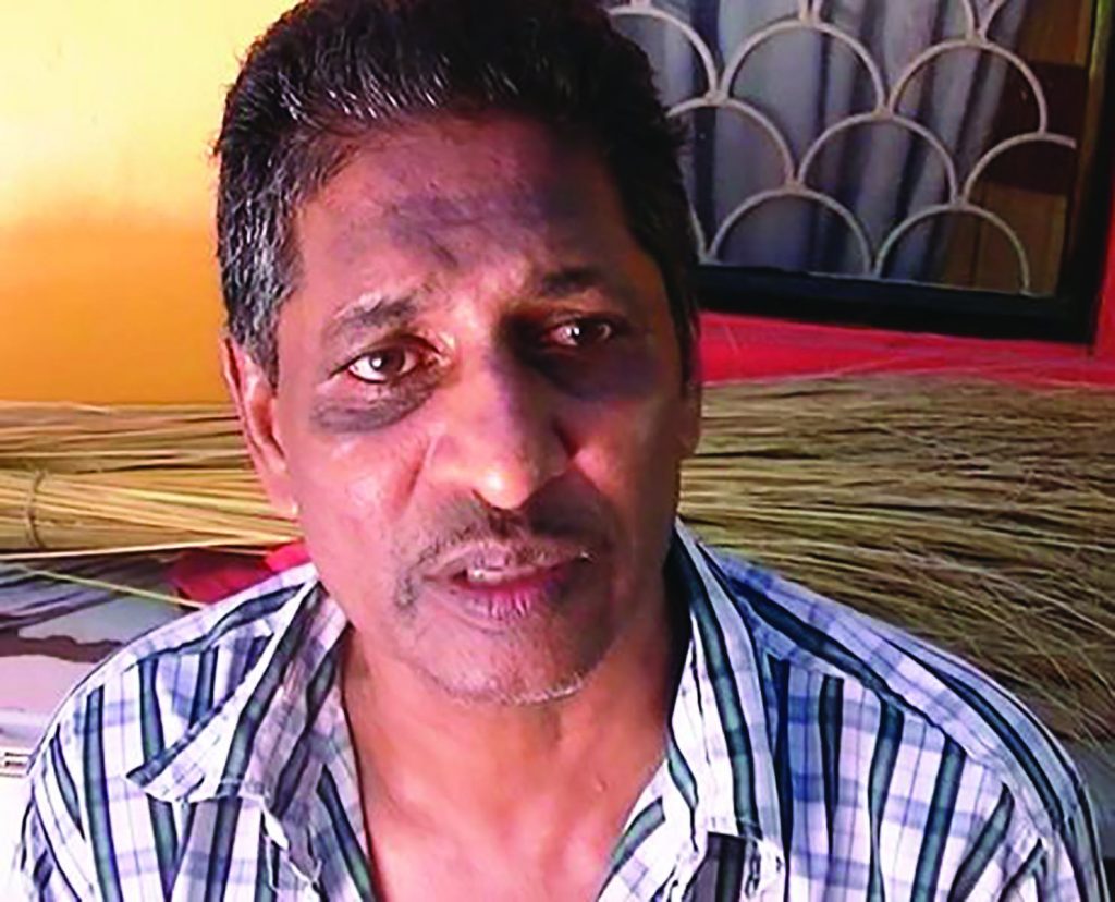 Robbery victim under investigation for staged attack - Guyana Times