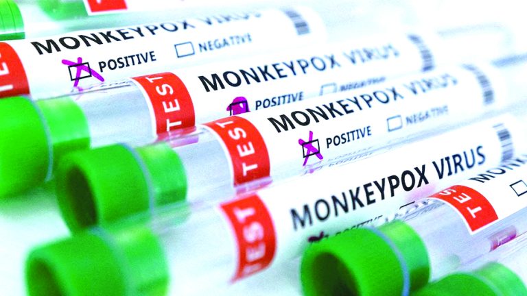 Health authorities facing difficulties with contact- tracing for 1st monkeypox case - Guyana Times