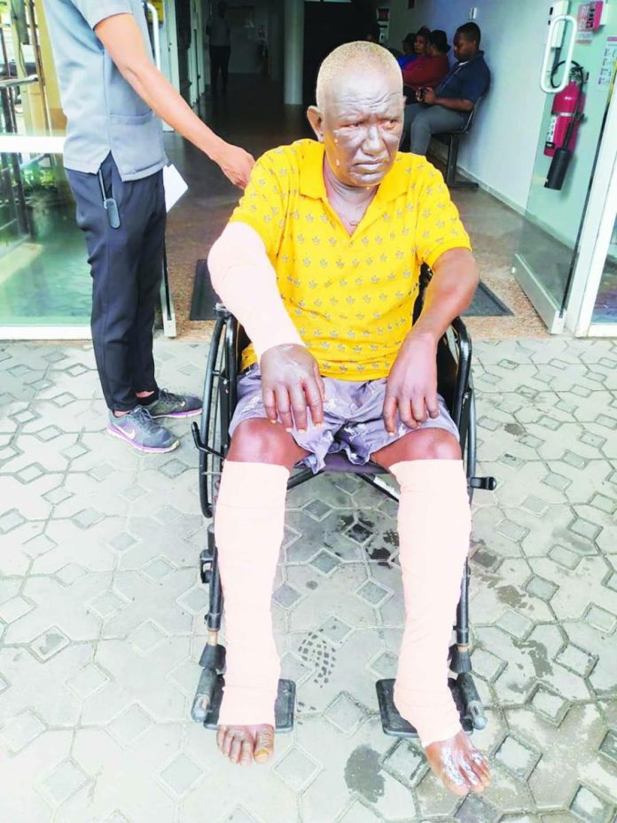 Man seeking justice after fiery Mahaicony crash - Guyana Times