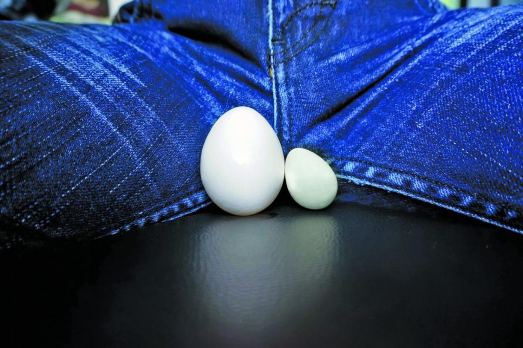 HYDROCELE - (WATER AROUND TESTICLES) - Guyana Times