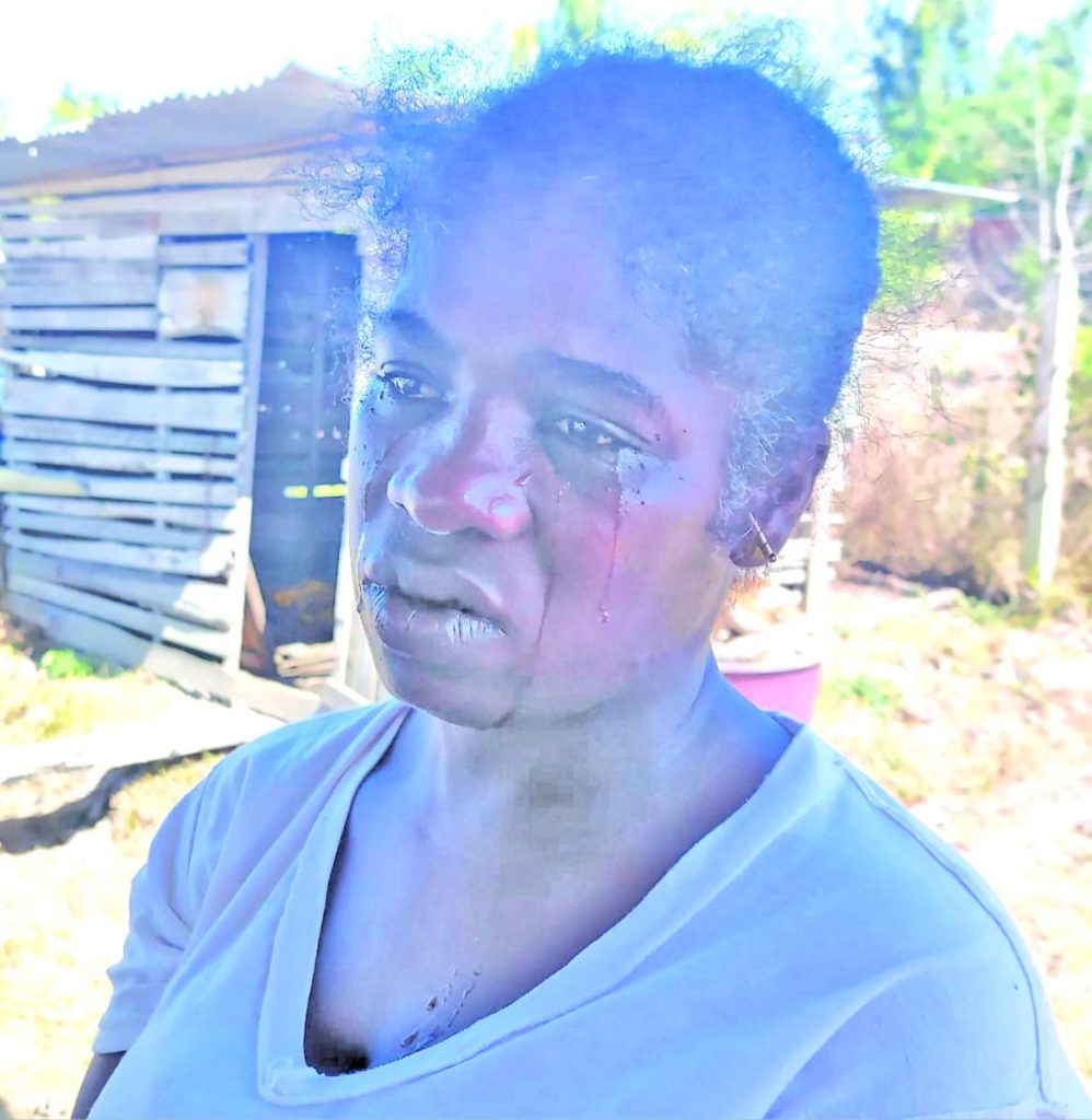 East Canje teen stabbed to death - Guyana Times