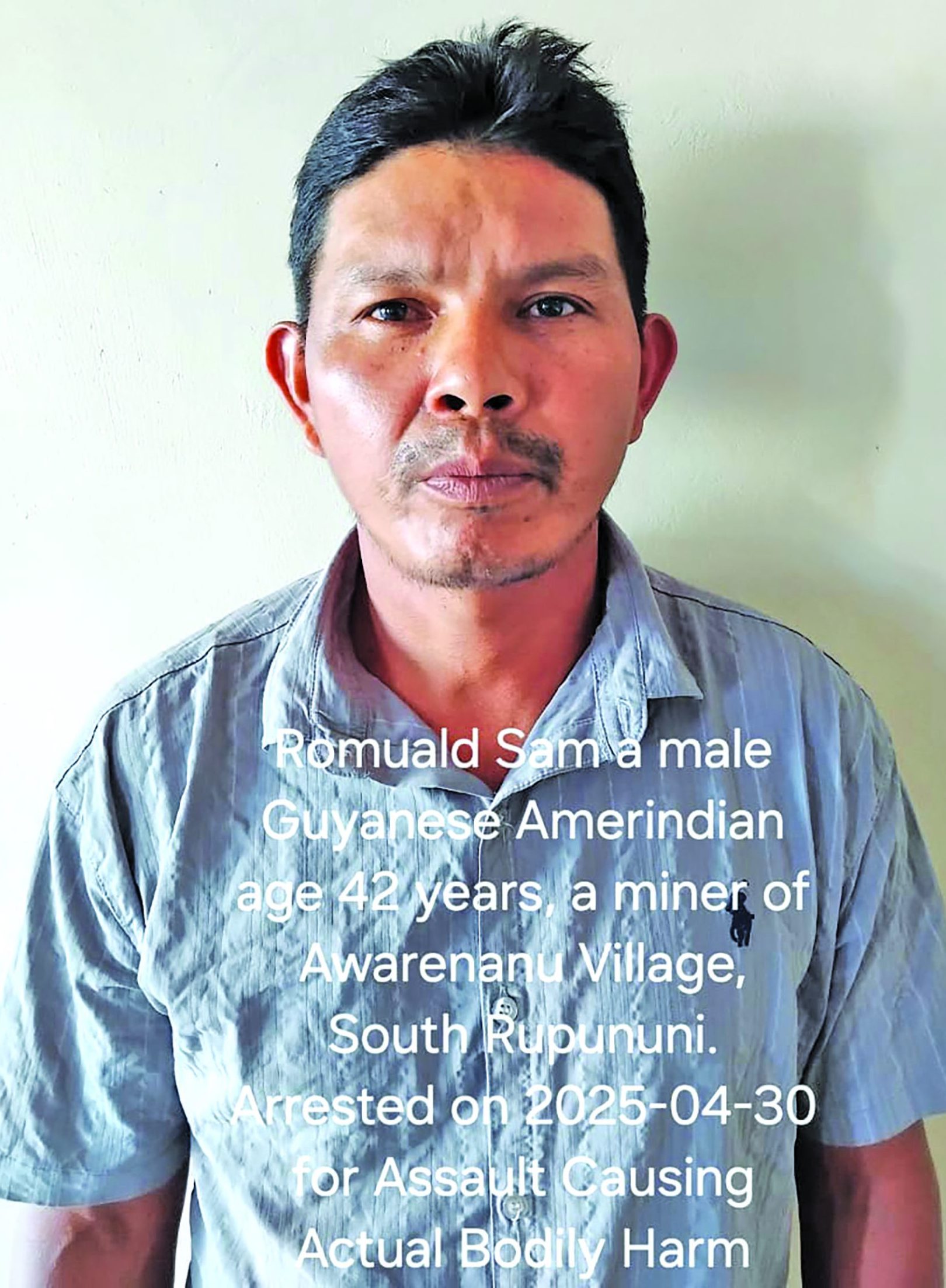 Miner granted bail on assault charge - Guyana Times